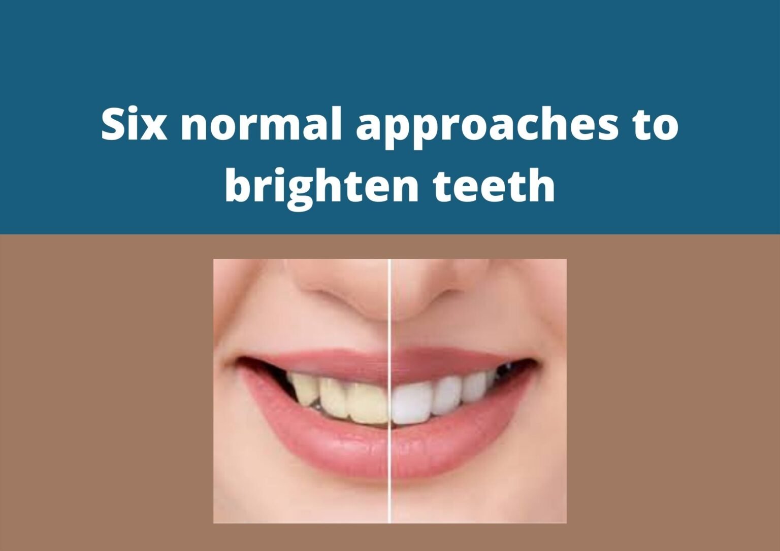 Six Normal Approaches To Brighten Teeth » My Vision Of Health